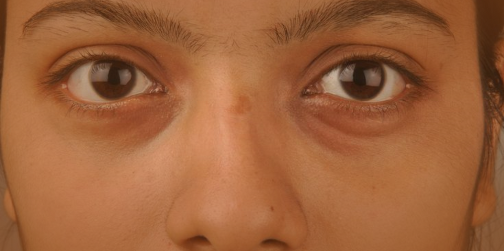 Decode Your Face: Is Lymphatic Congestion Affecting Your Skin? – Nabhi ...